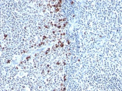 Human Kappa Light Chain Monoclonal Mouse Antibody (HP6053) - Biotium 中国 ...