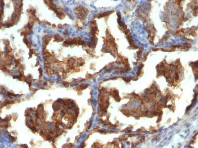 Mucin 1 / EMA / Episialin / CD227 Monoclonal Mouse Antibody (MUC1/955 ...