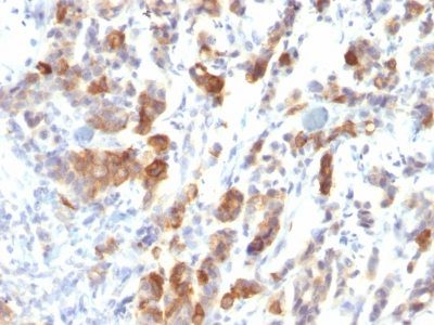 Mucin 5AC / MUC 5AC Monoclonal Mouse Antibody (MUC5AC/917) - Biotium 中国 ...