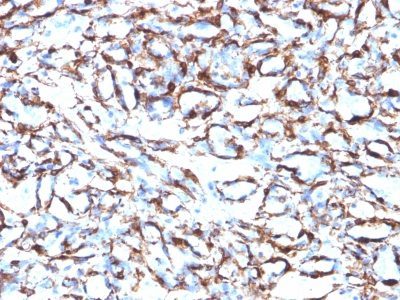 Smooth Muscle Actin Monoclonal Mouse Antibody (ACTA2/791) - Biotium 中国区 ...